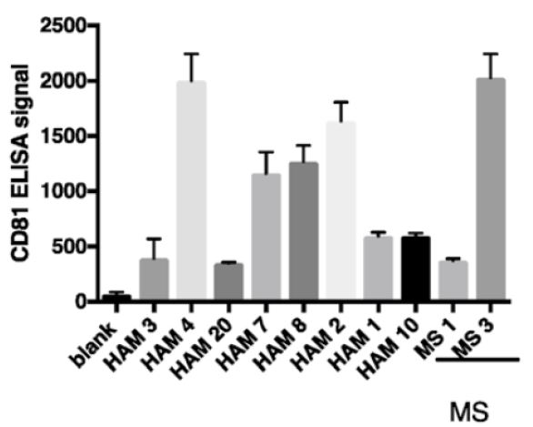 qEV Concentration Ki|最好的Exosome外泌體平台和實驗室儀器試劑都在這裡｜諾曼達科技